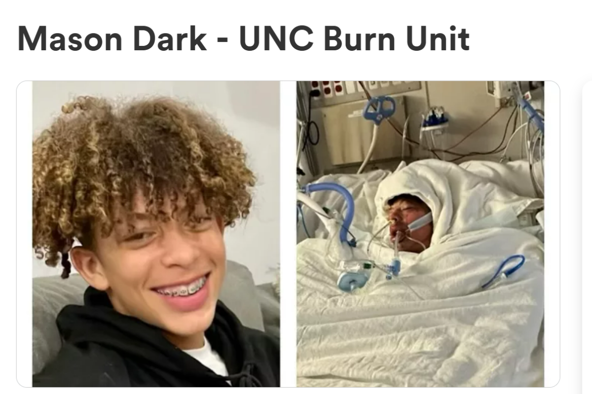 「スプレーで火炎放射」の動画撮影で事故、スプレー缶爆発で大やけど | IT NEWS